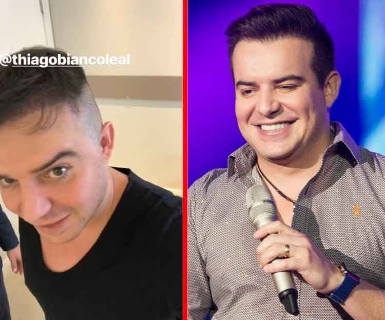 Entenda o transplante capilar feito pelo cantor sertanejo Belutti ...